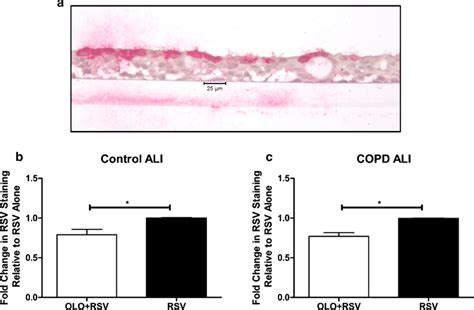 The Effect Of Olodaterol On Rsv Infections Rsv Staining Was Used To Download Scientific