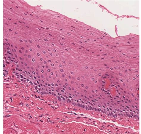 Solved A Lining Of The Esophagus Label 1 Free Surface 2