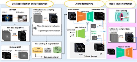 Figure 1 From A Deep Learning Framework For Cardiac Mr Under Sampled Image Reconstruction With A