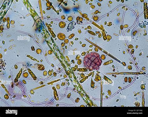 Various Microscopic Algae Including Flagellates Diatomes And Filamentous Green Algae As Well Av