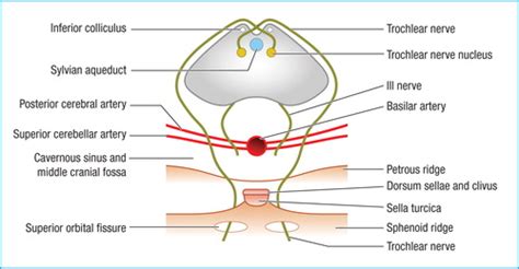 Trochlear Nerve