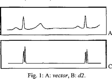Figure 1 From Beat Detection And Classification Of Ecg Using Self Organizing Maps Semantic Scholar