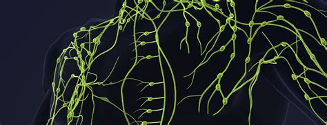 Venolymphatic Malformation Johns Hopkins Medicine