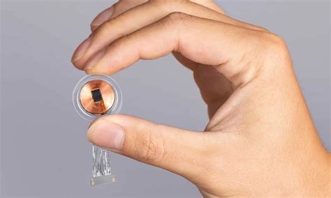 Neuralink After First Successful Implant What Comes Next