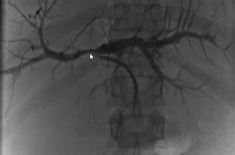 Mmkenawi Surgical Radiology