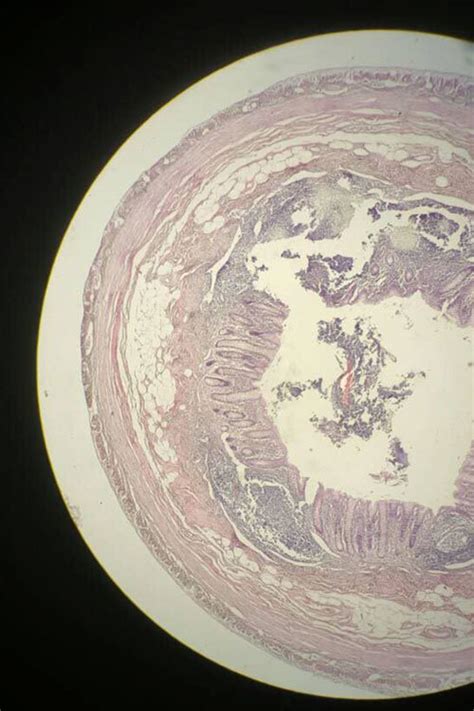 Microscopic View Of The Second Specimen With A Nearly Normal Appendix Download Scientific