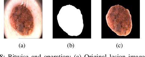 figure 1 from a modified unet for skin lesion segmentation using