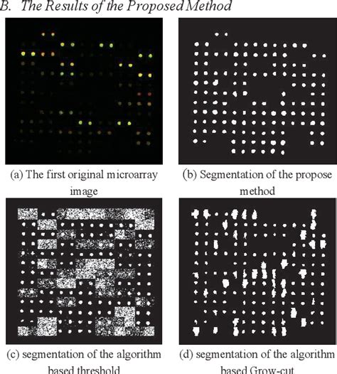 Figure 7 From Microarray Image Segmentation Based On Level Set And Regridding Semantic Scholar