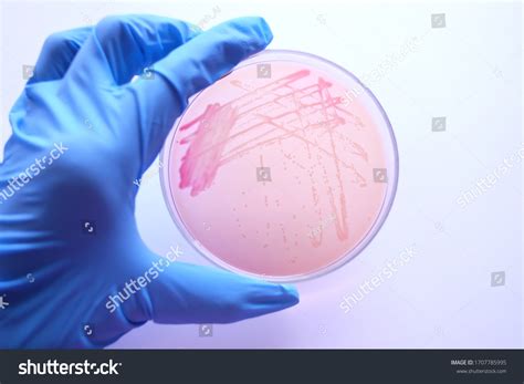 6 Cronobacter Bilder Stockfotos Und Vektorgrafiken Shutterstock