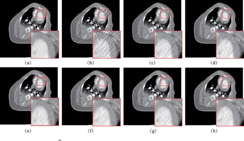 Figure 1 From Robust Low Dose Ct Sinogram Preprocessing Via Exploiting Noise Generating