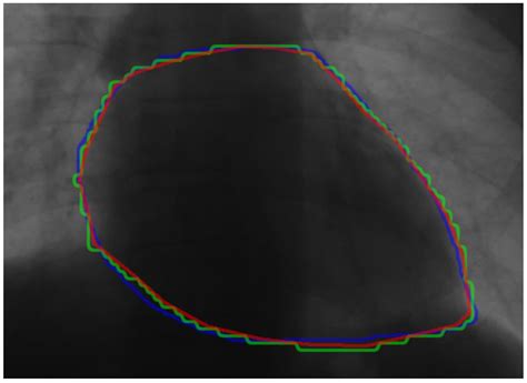Applied Sciences Free Full Text A Segmentation Method Based On