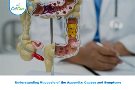 Role Of The Mesoappendix In Appendicitis