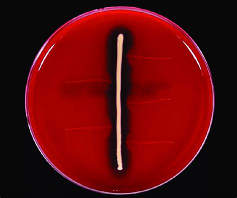 Reverse Camp Test Arcanobacterium Haemolyticum Is Streaked Download Scientific Diagram