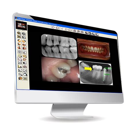 Quickview Dental Imaging Software Denterprise International Inc