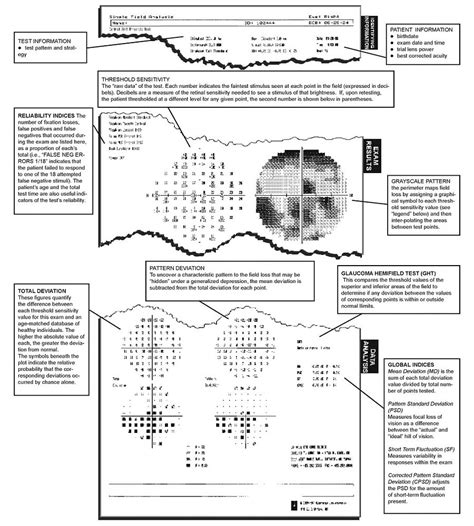 Visual Field Testing