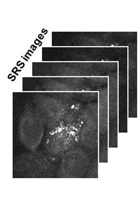 Quantitative Vibrational Imaging By Hyperspectral Stimulated Raman