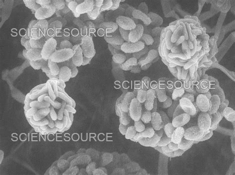 Photograph Stachybotrys Chartarum Science Source Images