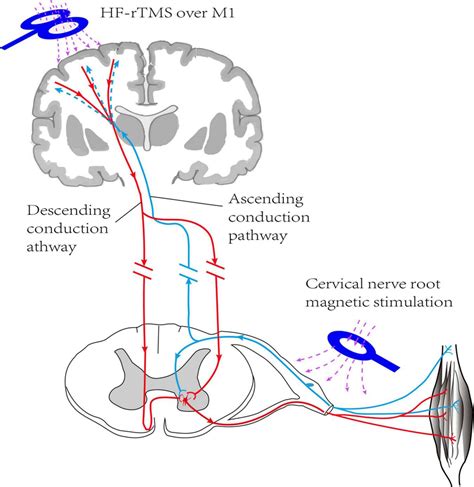Schematic Diagram Of Hf Rtms Over Ipsilateral M1 Combined With Magnetic Download Scientific