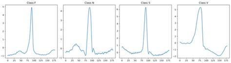Classifying Cardiac Arrhythmia From Ecg Signal Using 1d Cnn Deep Learning Model