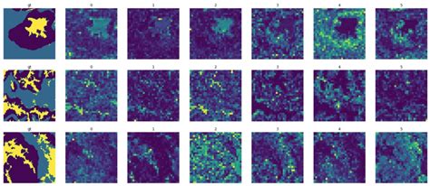 Ai Summer On Linkedin Transformer Based Self Supervised Learning For
