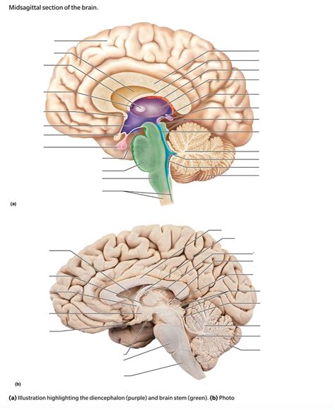 Infundibulum Brain Model