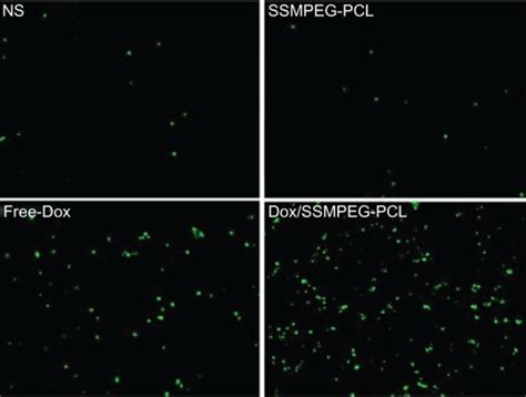 Detection Of Apoptotic Tumor Cells By Tunel Assay Notes The Assay Download Scientific Diagram
