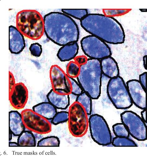 Figure 6 From Oriented Cascade Mask R Cnn For Biomedical Image Segmentation Semantic Scholar
