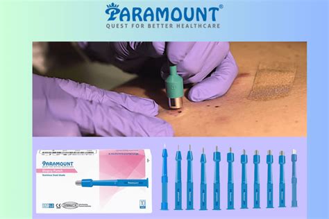 Biopsy Punch Tool Uses In Essential Tissue Sampling Paramount