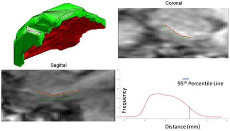 Panel 1 Shows An Example Of The Surface Meshes Generated From Download Scientific Diagram
