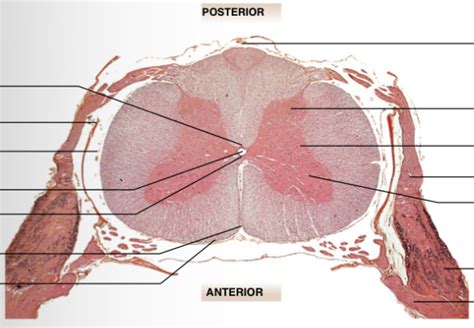 Pns Practicum Transverse Spinal Cord Diagram Quizlet