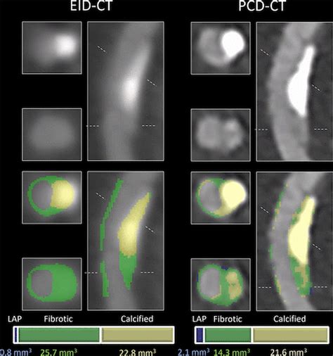 New Analysis Forecasts Substantial Cost Savings With The Use Of Photon