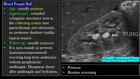 Echogenic Foci With No Ultrasound Guided Tips Facebook
