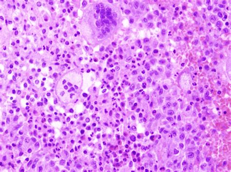 Langerhans Cells Histology