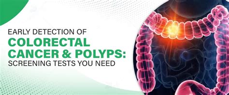 Early Detection Of Colorectal Cancer And Polyps Screening Tests You Need
