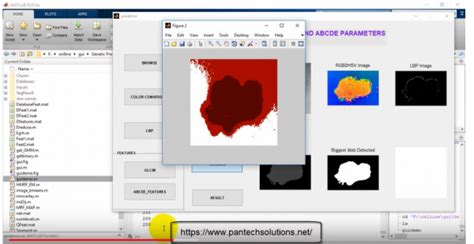 Skin Disease Detection Using Matlab