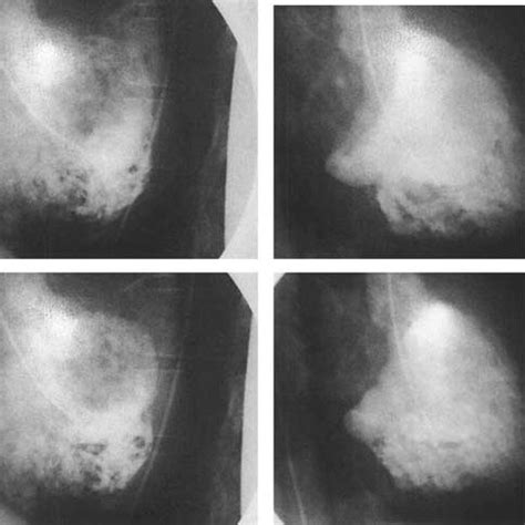 Left Ventriculogram Images On The Left Are Right Anterior Oblique And Download Scientific