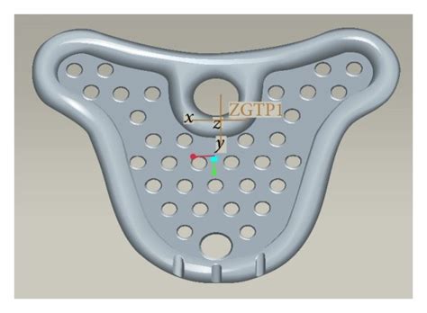 Types Of Iud A Lippes Loop Patent Number Us3802425 A Many Download Scientific Diagram
