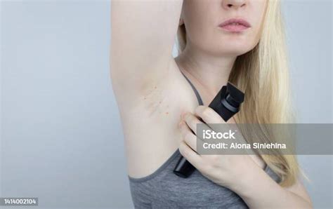겨드랑이 발진 겨드랑이 피부 자극 금발 소녀는 면도기 트리머 탈취제 또는 발한 억제제를 사용한 후 피부에 자극을 나타냅니다 알레르기 또는 자극 여드름 또는 붉은 반점 건강