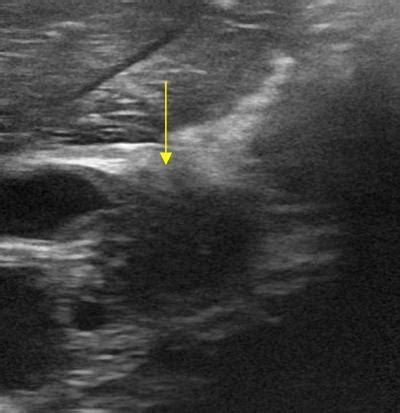 Abdomen And Retroperitoneum 1 2 Gallbladder And Bile Ducts Case 1 2