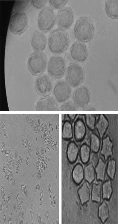 Acanthamoeba Cyst Morphology