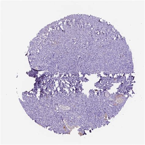 Tissue Expression Of Apoe Staining In Ovary The Human Protein Atlas