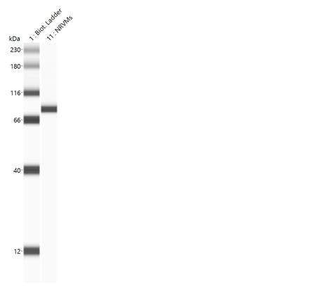 Scn3b Antibody S396 29 Bsa Free Nbp2 59318 Novus Biologicals Scn3b Antibody S396 29 Bsa Free Nbp2 59318 Novus Biologicals