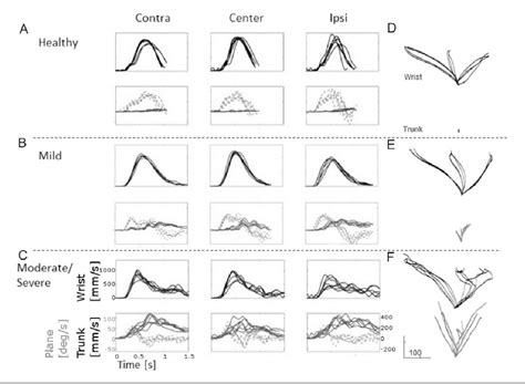 Table 1 From Compensatory Versus Noncompensatory Shoulder Movements