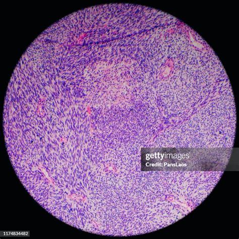 Virus Under The Microscope Photos And Premium High Res Pictures Getty