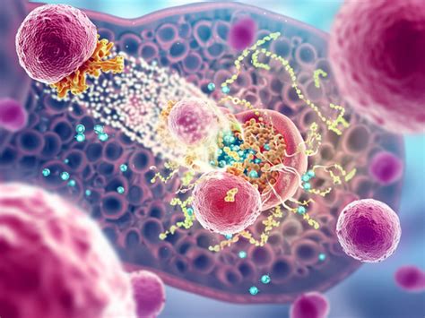 前列腺肿瘤神经侵犯症状与预后 前列腺钙化合并psa升高处理流程 癌友网