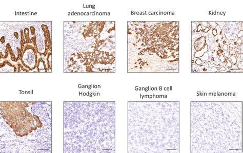 Antibody Validation Innovative Staining Solutions To Support Your Antibody Validation Process