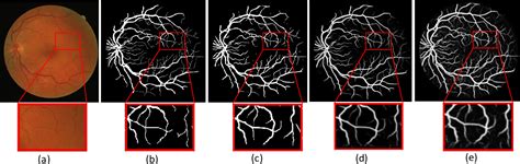 figure 2 from multi scale and multi branch convolutional neural network