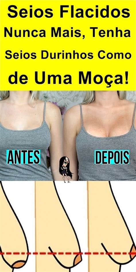 Pin Em Aumentar Os Seios