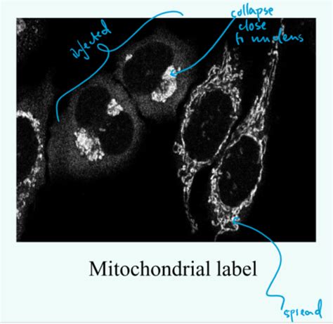 Subcellular Organelles And Trafficking Flashcards Quizlet