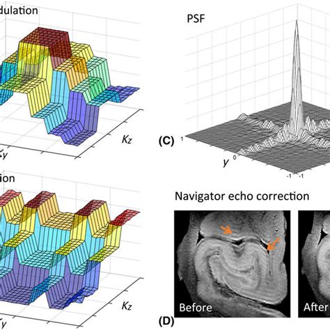 Diffusion Weighted Radiofrequency Rf Pulse Sequences A Download Scientific Diagram